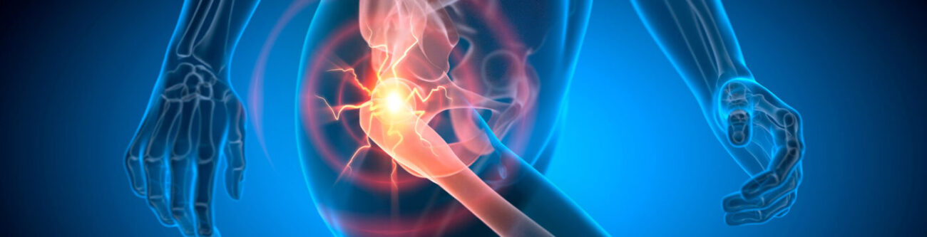 Hip Pain Treatment in St. Louis | Axes Physical Therapy